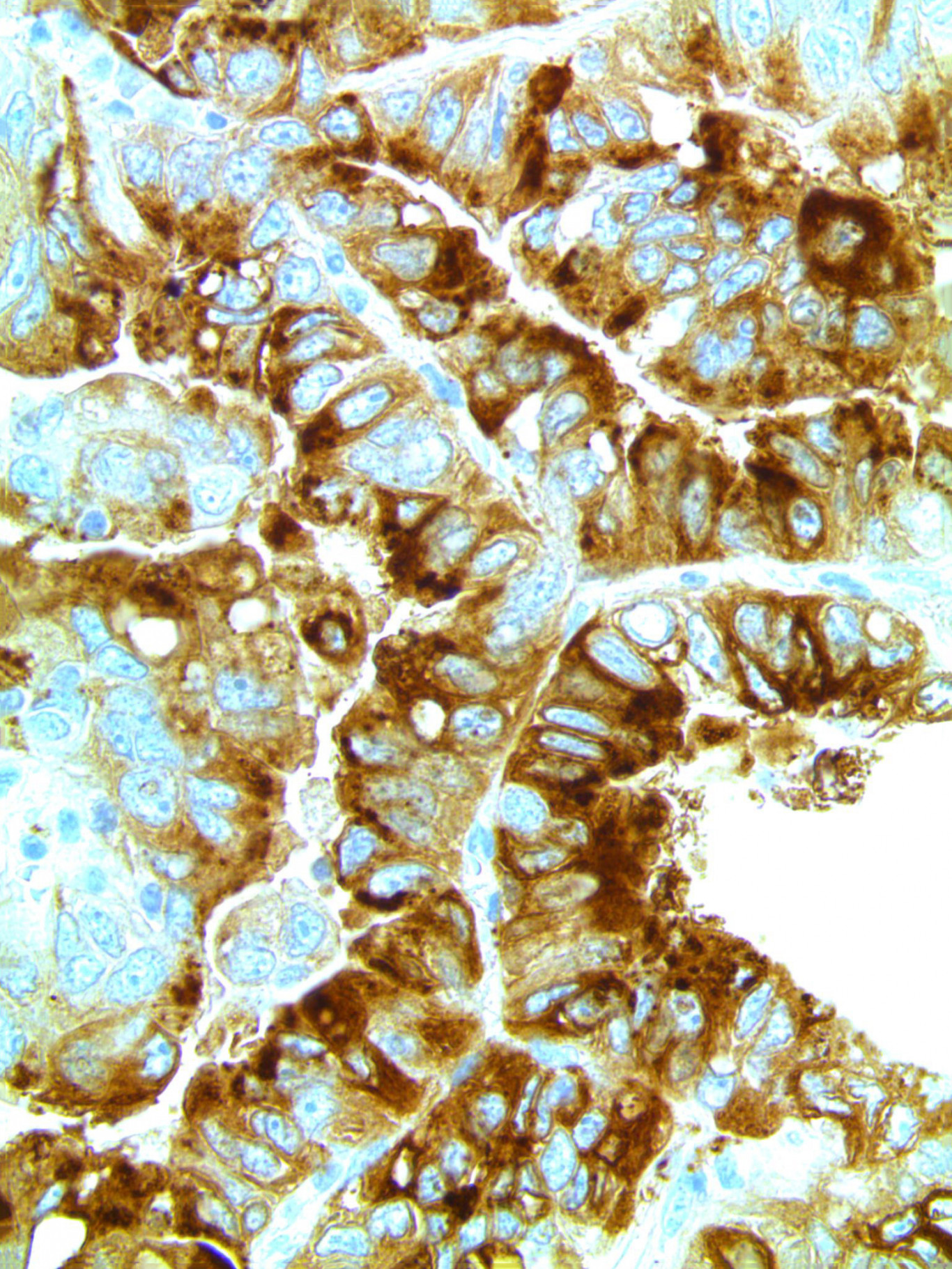 Mari Patel, DM » Incyte Diagnostics